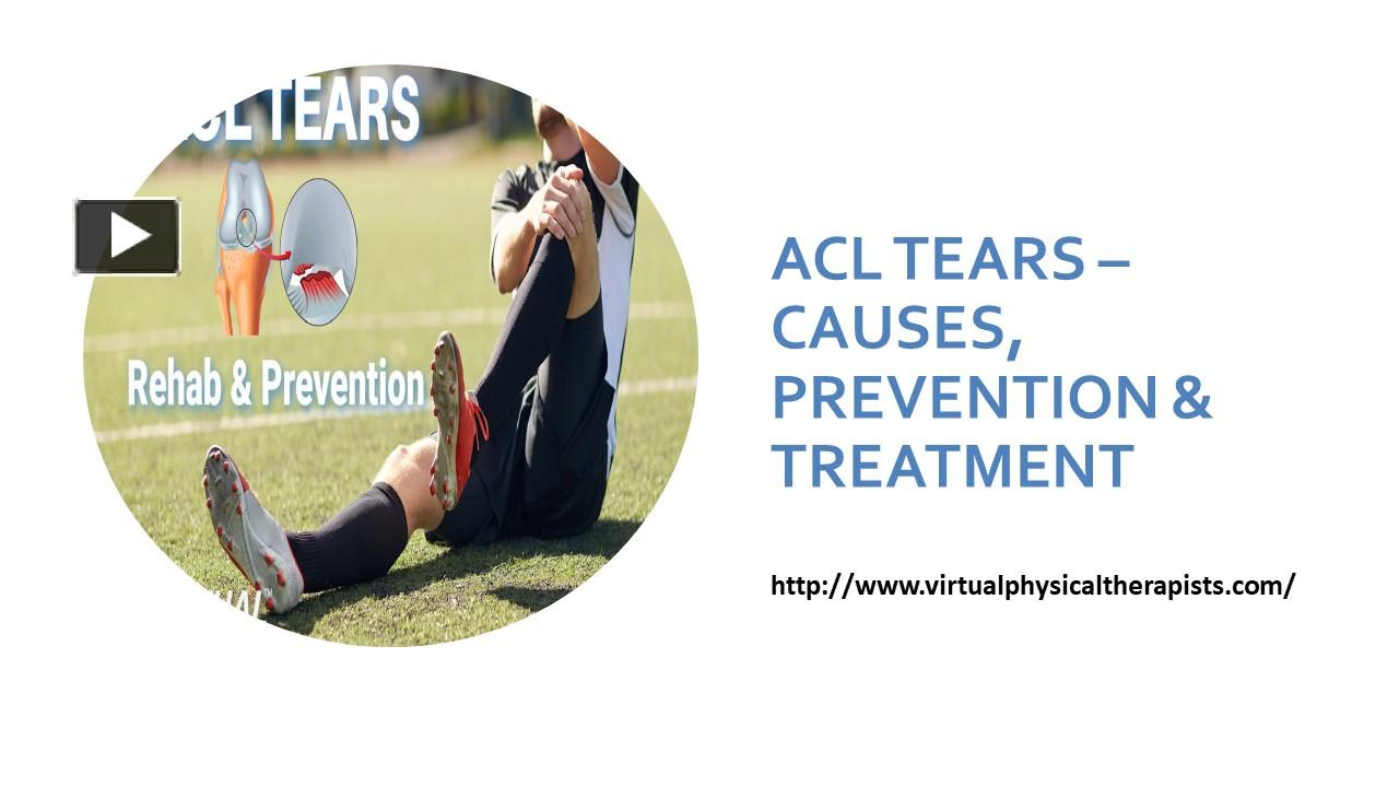 PPT – ACL TEARS – CAUSES, PREVENTION & TREATMENT PowerPoint ...
