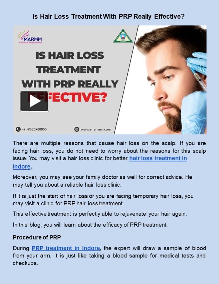 PPT – Is Hair Loss Treatment With PRP Really Effective? PowerPoint ...