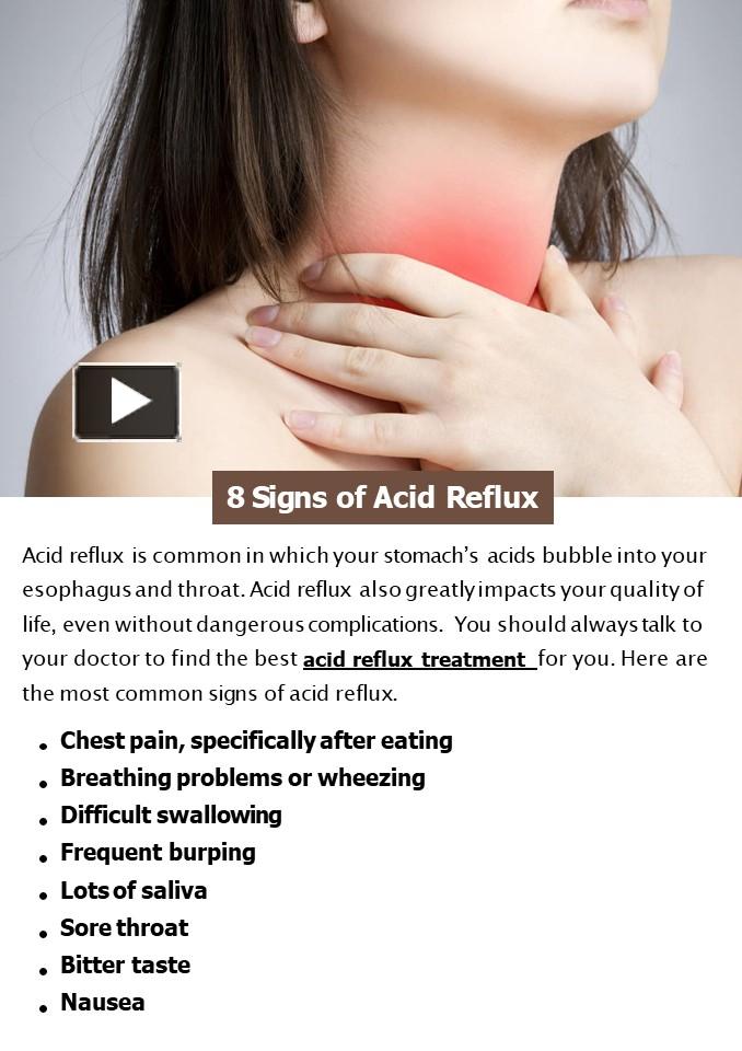 PPT – 8 Signs of Acid Reflux PowerPoint presentation | free to download ...