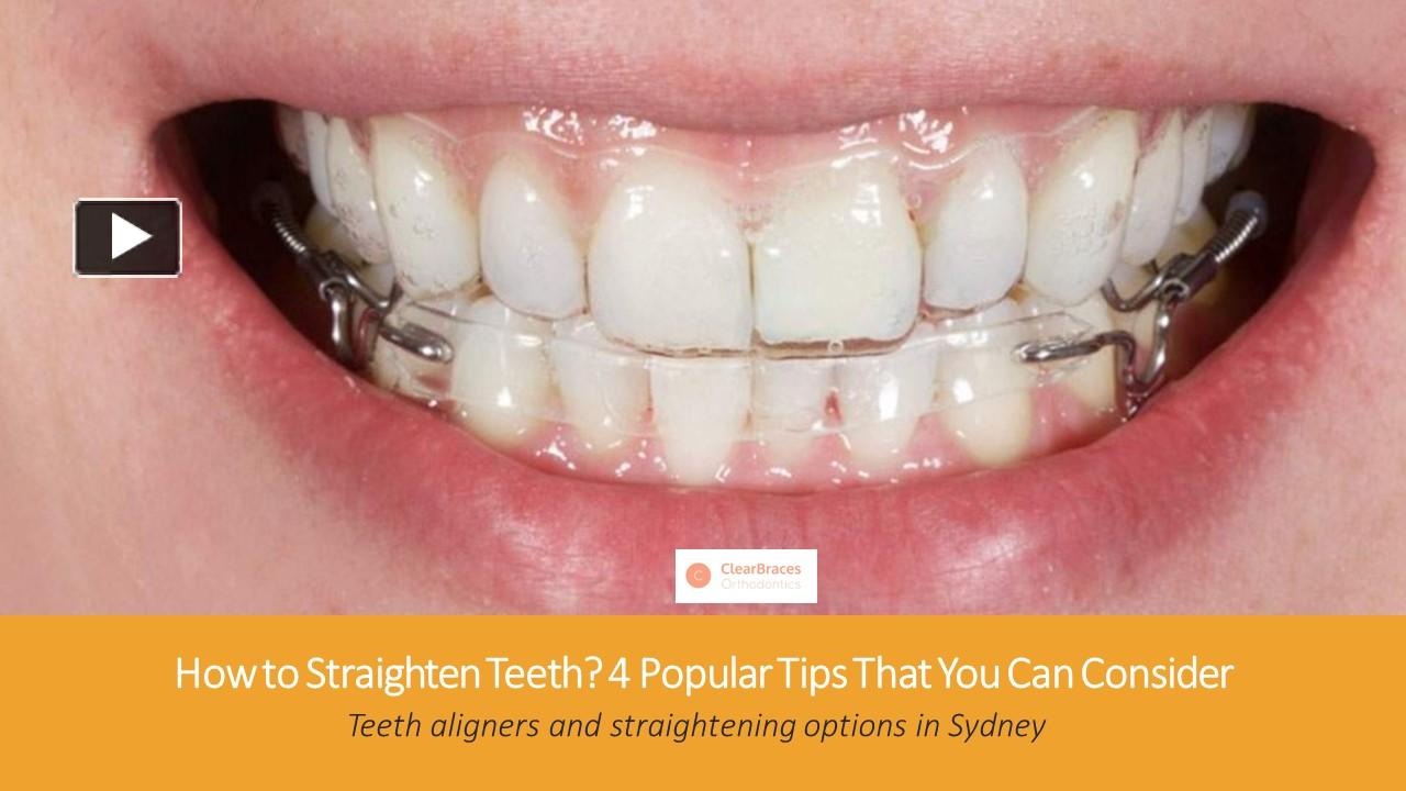 PPT – How to Straighten Teeth - 4 Popular Tips That You Can Consider ...