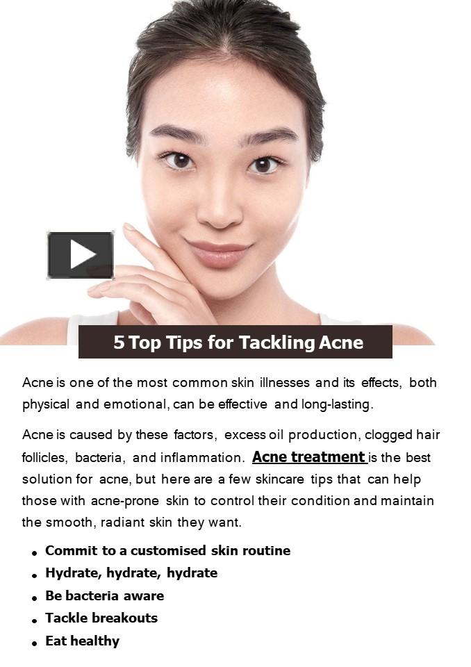 5 Top Tips for Tackling Acne presentation | free to download