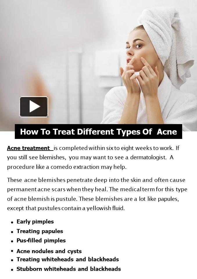 How To Treat Different Types Of Acne presentation | free to download