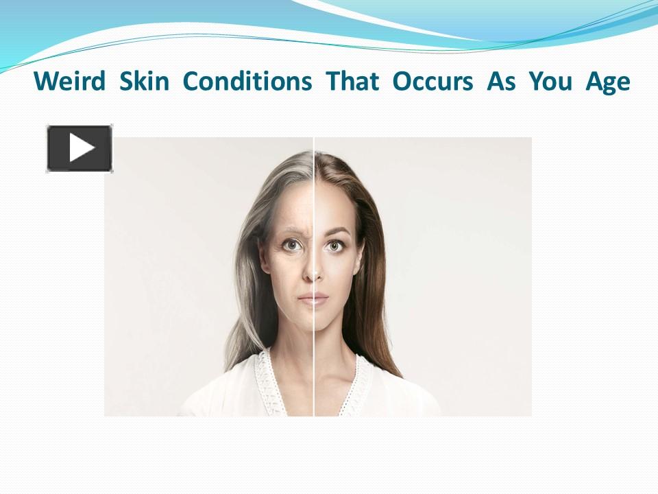 PPT – Weird Skin Conditions That Occurs As You Age (1) PowerPoint ...