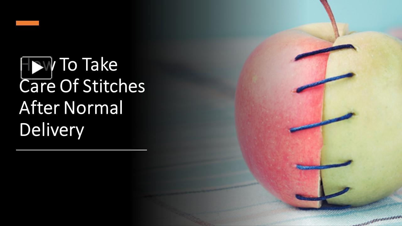 How To Take Care Of Stitches After Normal Delivery presentation | free ...