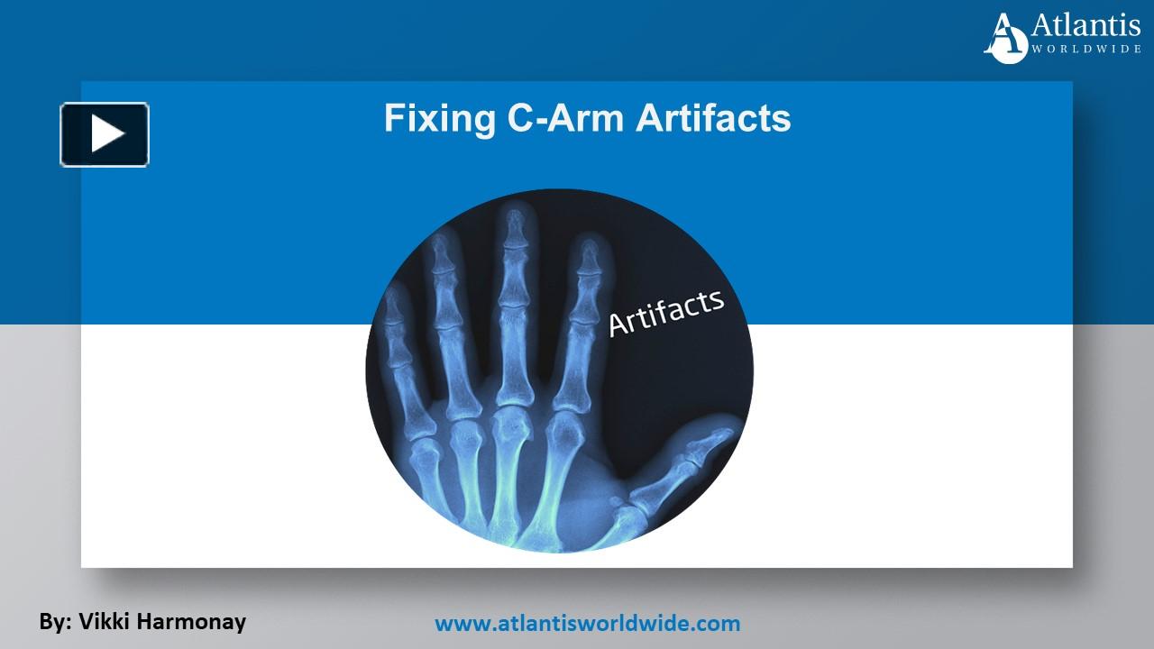 PPT – Fixing C-Arm Artifacts PowerPoint presentation | free to download ...