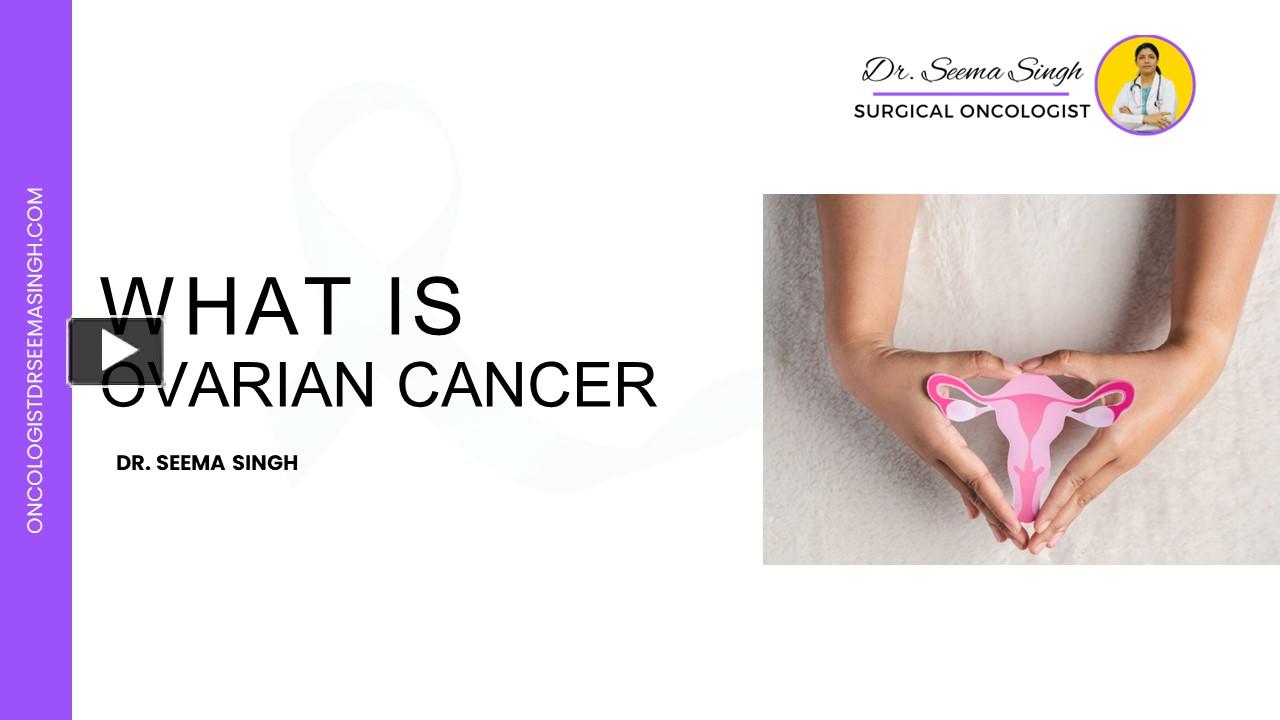 PPT – What is Ovarian Cancer? PowerPoint presentation | free to ...
