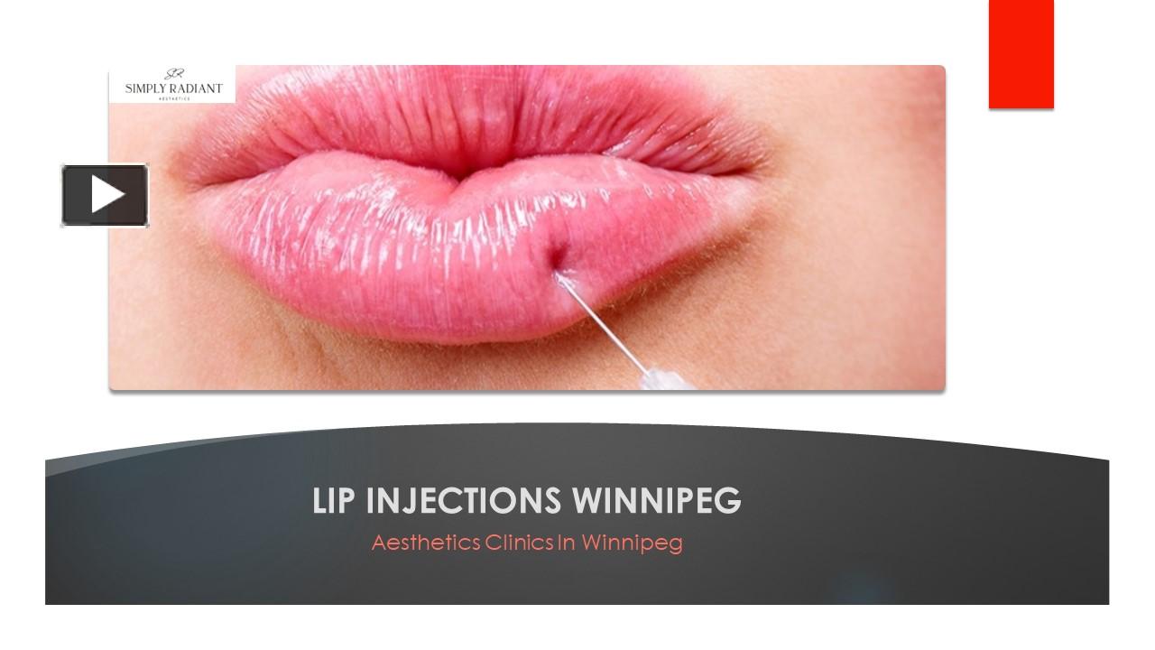 Lip Injections Winnipeg - Simply Radiant Aesthetics presentation | free ...