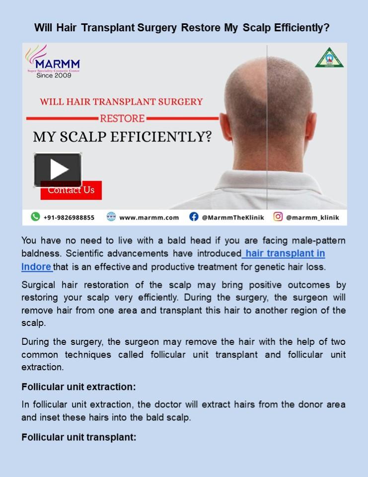 PPT – Will Hair Transplant Surgery Restore My Scalp Efficiently ...