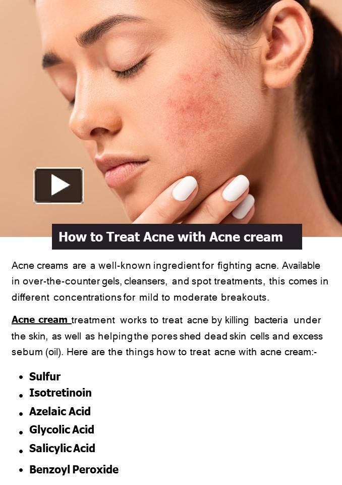 How to Treat Acne with Acne cream presentation | free to download