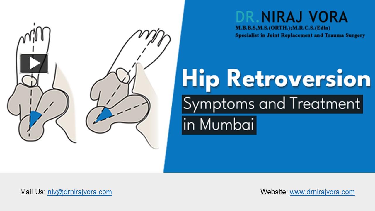 Hip Retroversion Symptoms and Treatment in Mumbai | Dr Niraj Vora ...