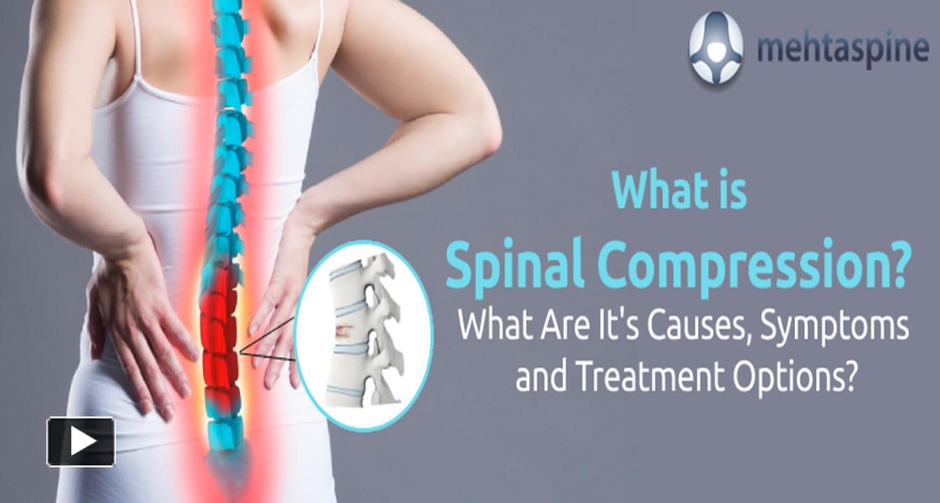 Spinal Compression Causes, Symptoms, and Treatment Options ...