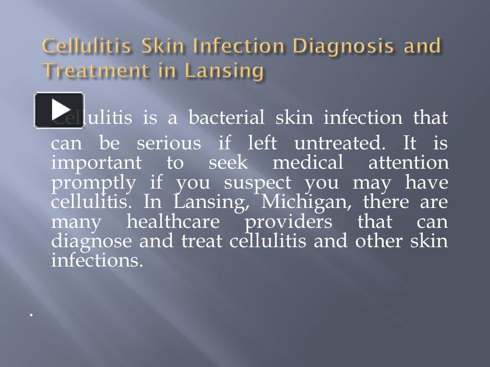 PPT – Cellulitis Skin Infection Diagnosis and Treatment in Lansing, MI ...