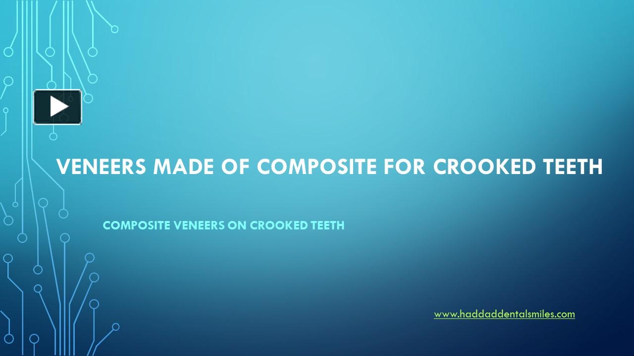PPT – Veneers Made of Composite for Crooked Teeth PowerPoint ...