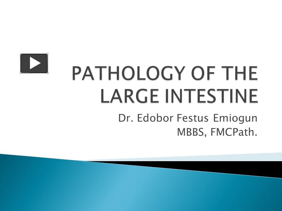 Pathology Of Large Intestine presentation | free to download