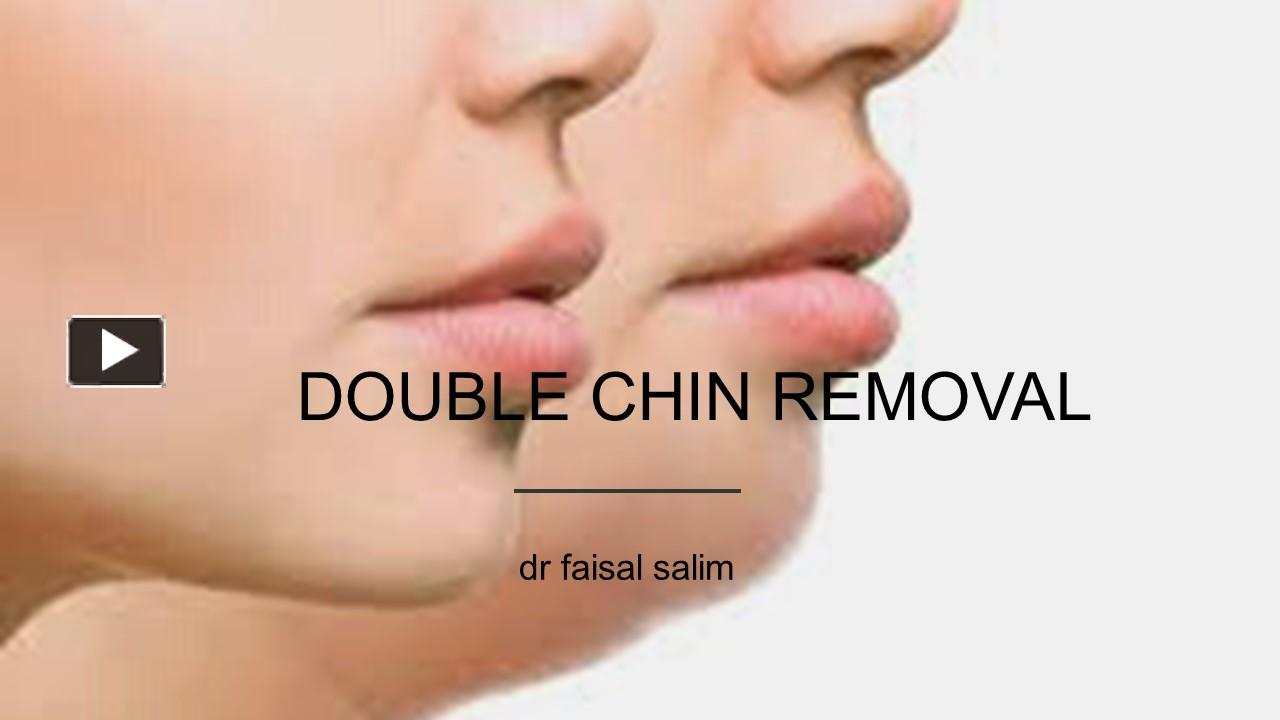 PPT – double chin reduction PowerPoint presentation | free to download ...