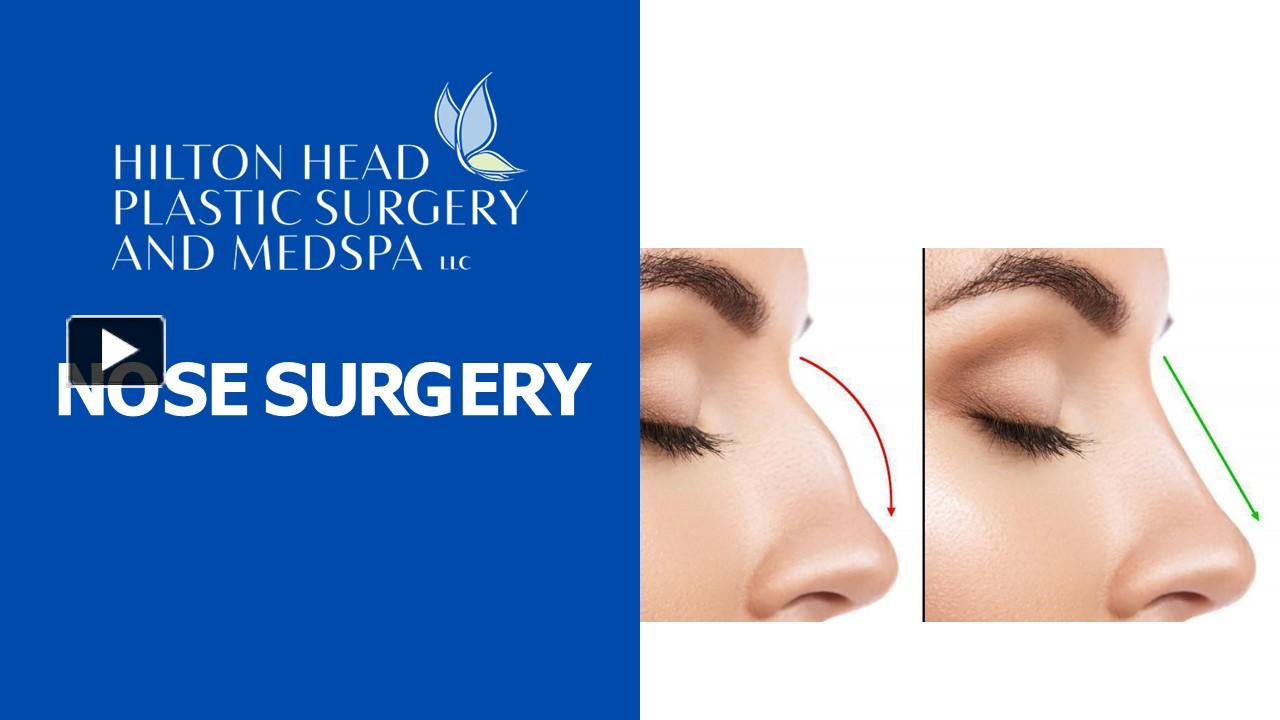 PPT – FIND TOP CLINIC OF NOSE SURGERY HILTON HEAD ISLAND PowerPoint ...