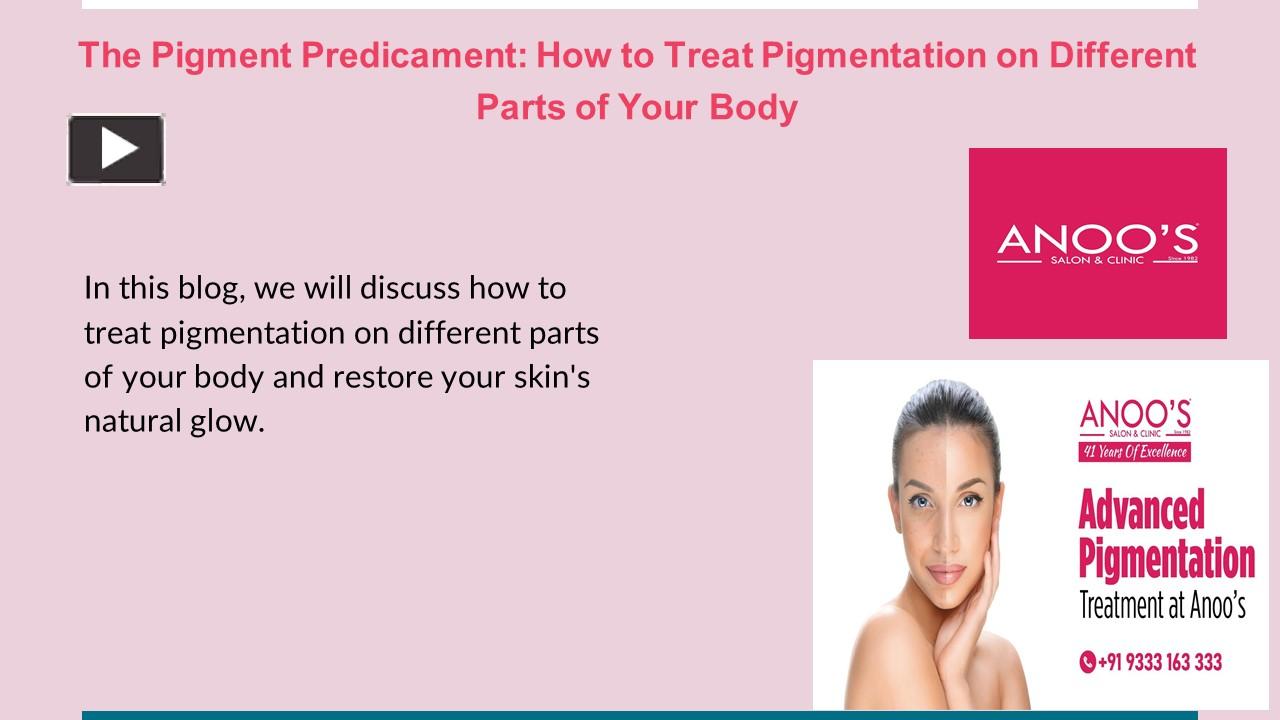 The Pigment Predicament: How to Treat Pigmentation on Different Parts ...