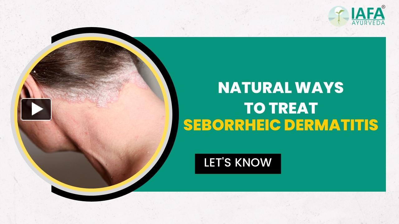 PPT – Natural treatment of seborrheic dermatitis PowerPoint ...