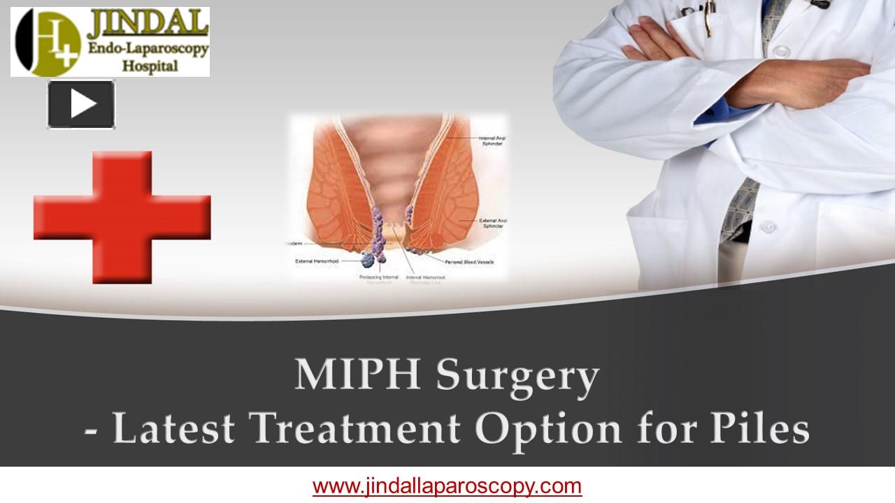 MIPH Surgery - Latest Treatment Option for Piles presentation | free to ...