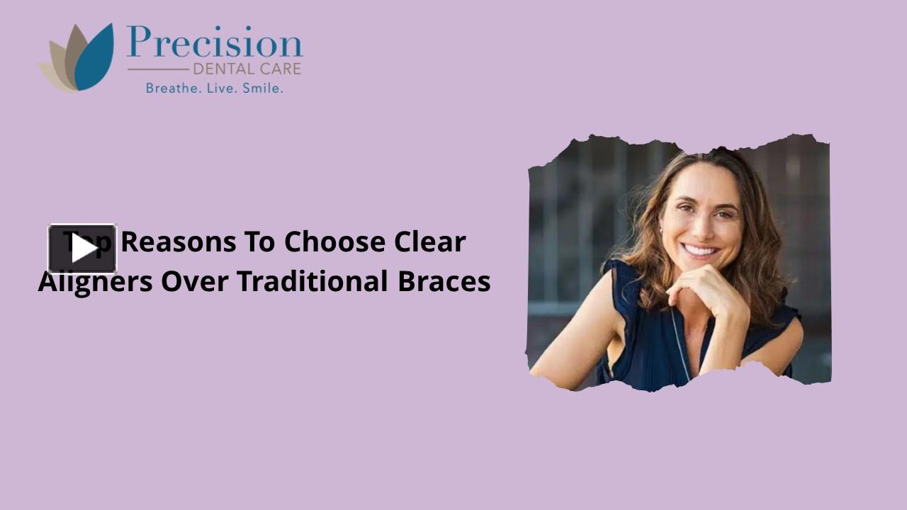 The Best Reasons To Choose Clear Aligners Over Traditional Braces ...
