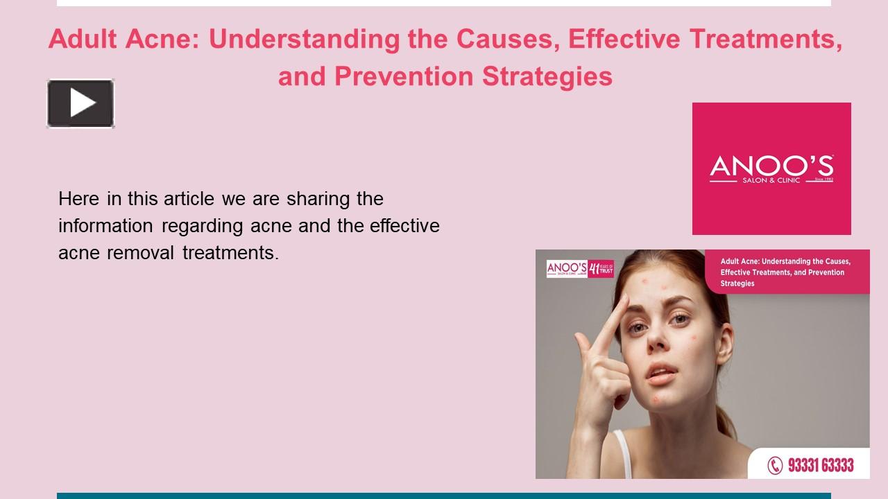 PPT – Adult Acne: Understanding the Causes, Effective Treatments, and ...
