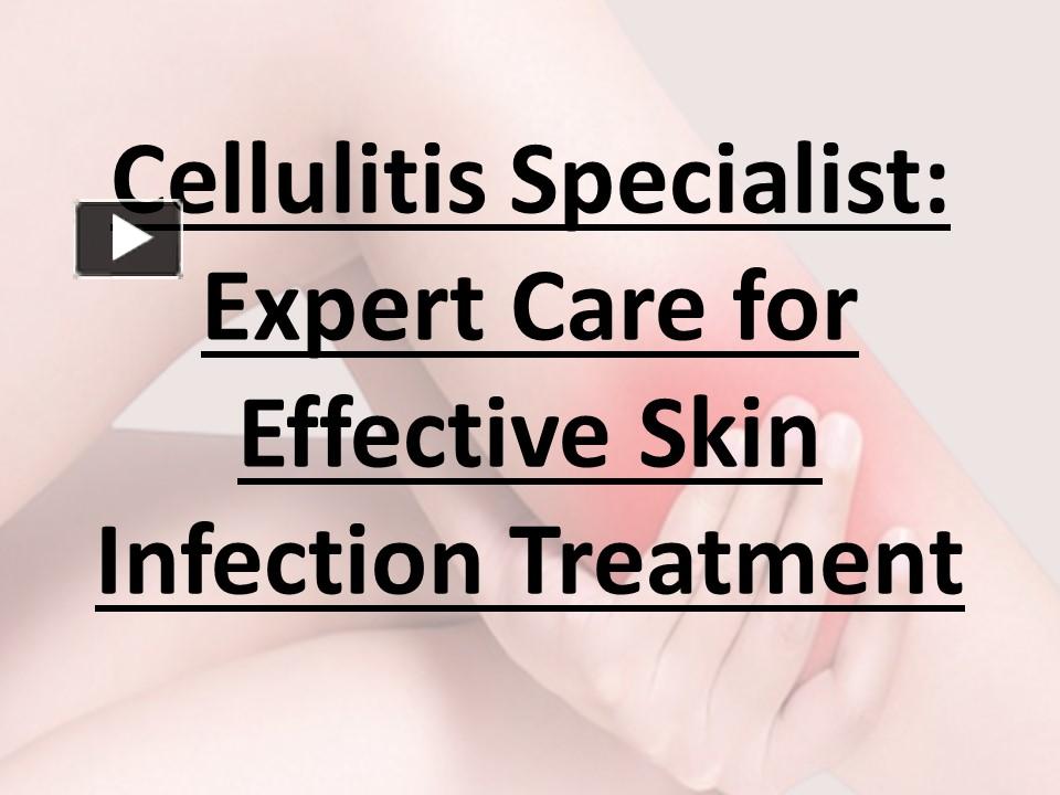 PPT – Cellulitis Specialist: Expert Care for Effective Skin Infection ...