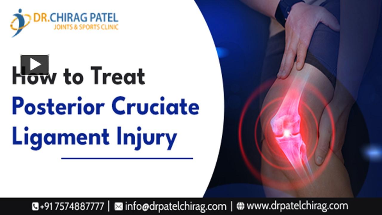 PPT – PCL Injury | How to Treat Posterior Cruciate Ligament Injury ...
