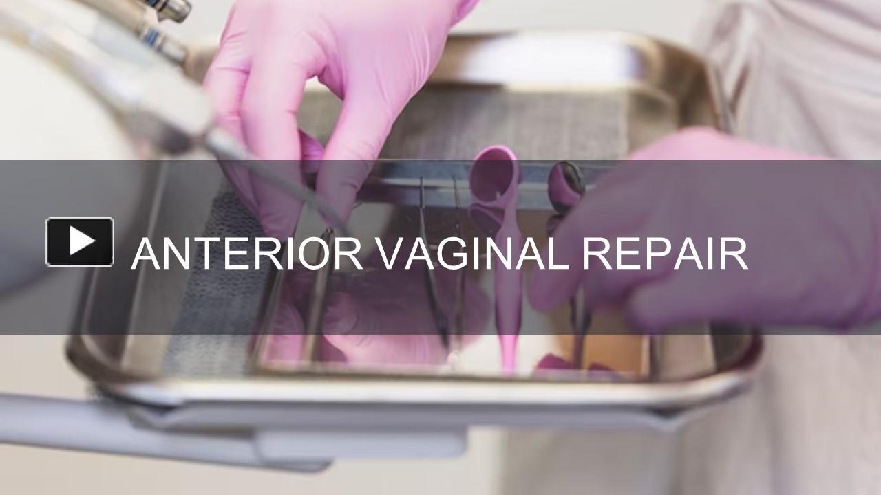 PPT – Anterior Vaginal Repair PowerPoint presentation | free to ...