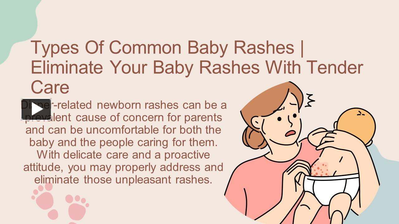 PPT – Types Of Common Baby Rashes | Eliminate Your Baby Rashes With ...