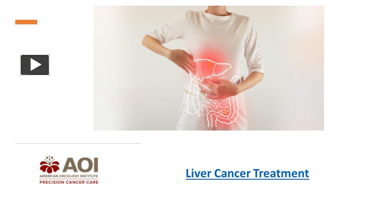 PPT – The Role of Immunotherapy in Treating Liver Cancer PowerPoint ...