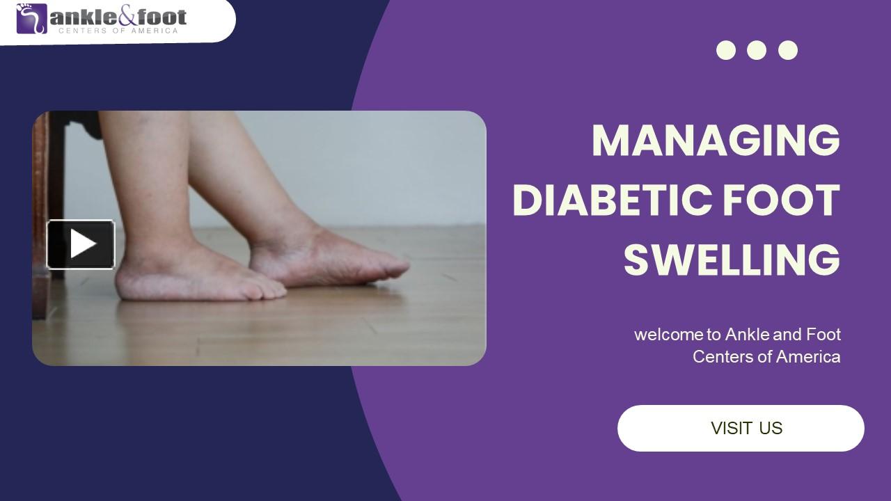 Managing Diabetic Foot Swelling presentation | free to download