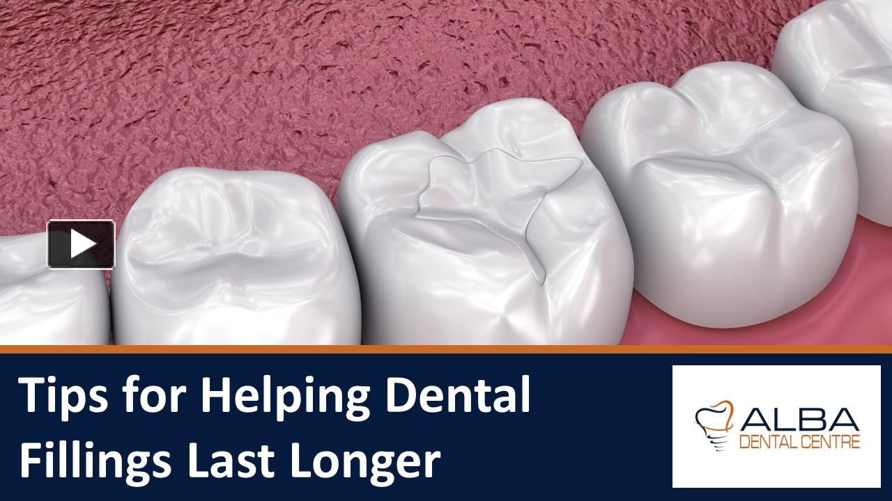 PPT – The Tooth-Filling Lifespan PowerPoint presentation | free to view ...