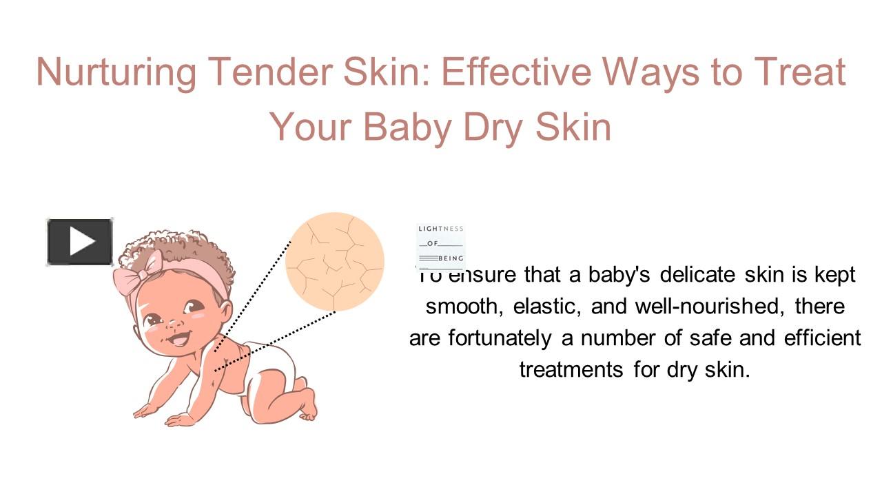 Effective Ways to Treat Your Baby Dry Skin presentation | free to download