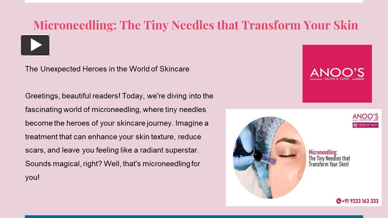 PPT – Microneedling: The Tiny Needles that Transform Your Skin ...