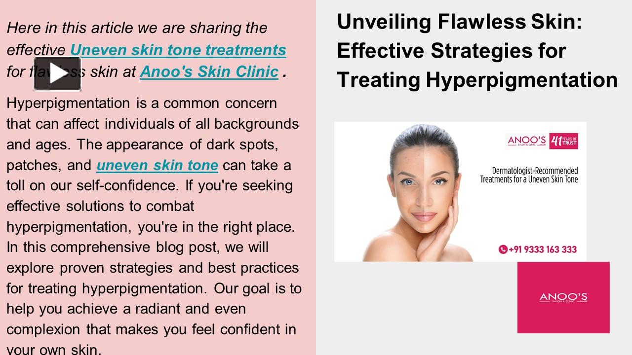 Unveiling Flawless Skin: Effective Strategies for Treating ...