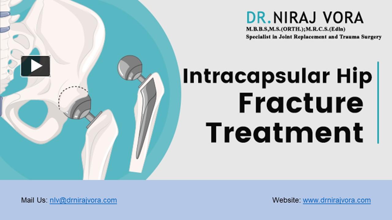 Intracapsular Hip Fracture Treatment | Dr Niraj Vora presentation ...
