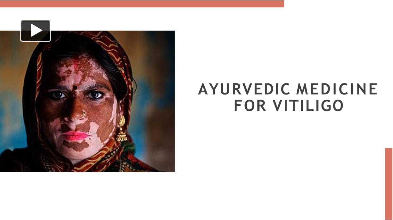 Leucoderma treatment in ayurveda presentation | free to download