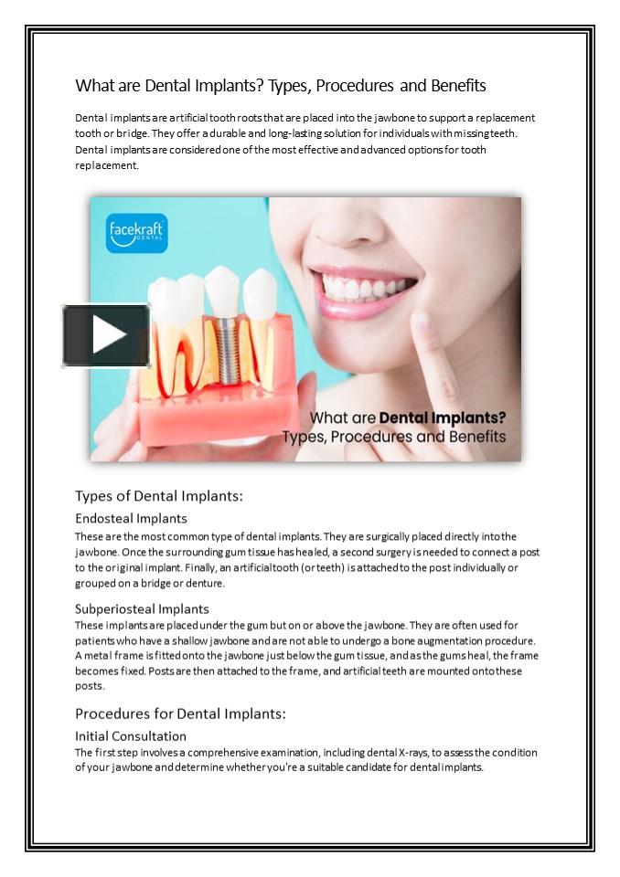 What are Dental Implants? Types, Procedures and Benefits presentation ...