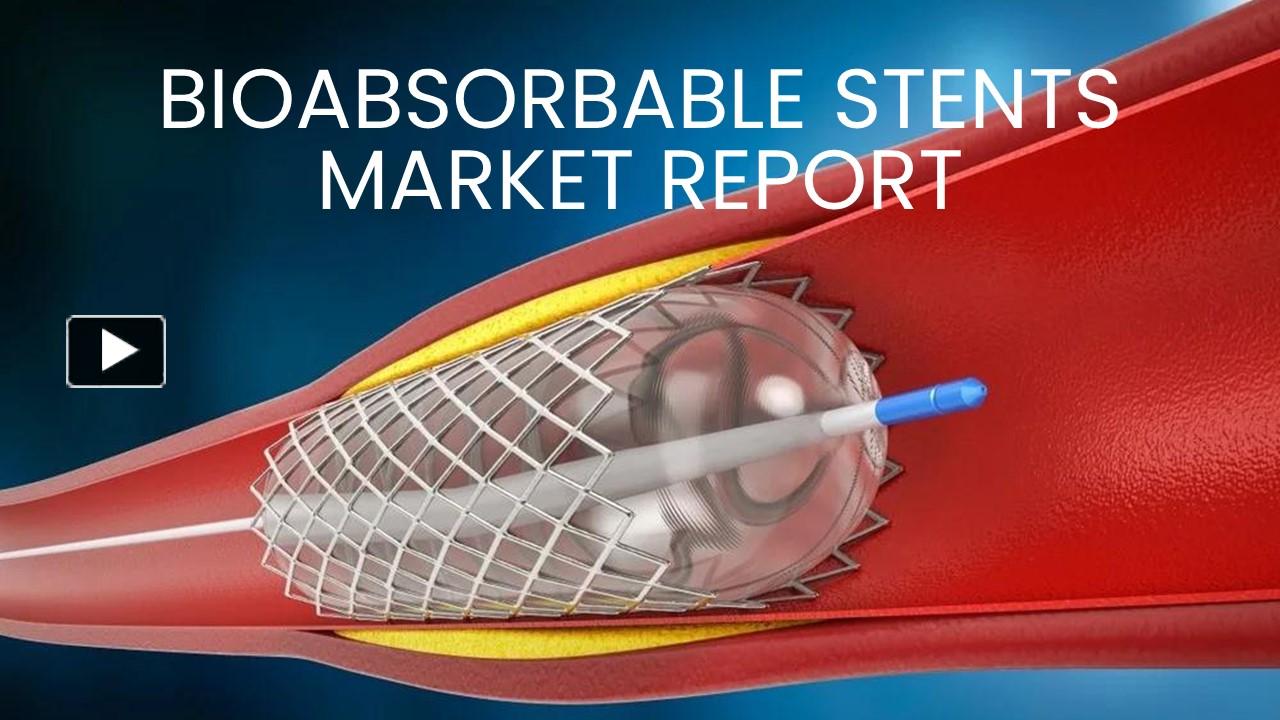 Bioabsorbable Stents Market Report presentation | free to download