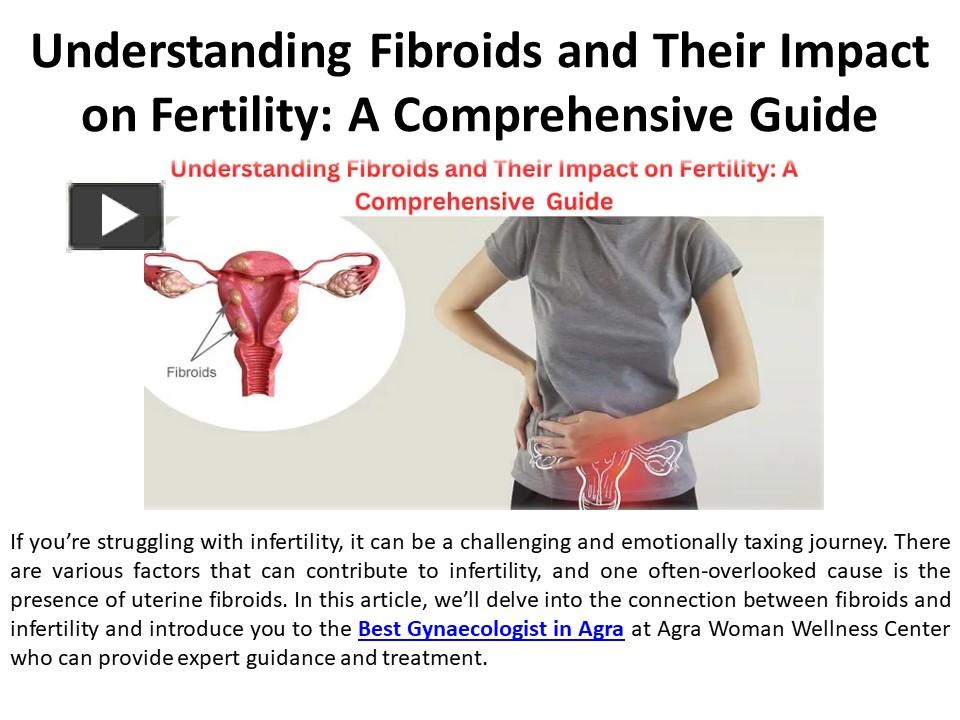 Understanding Fibroids and Their Relationship to Fertility presentation ...