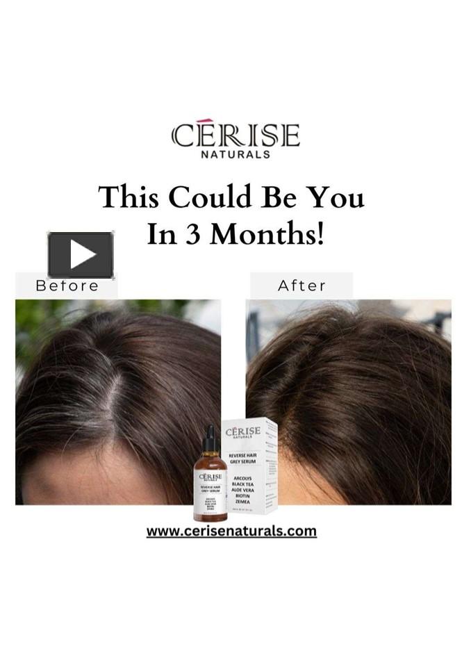 PPT – Arcolys for hair PowerPoint presentation | free to download - id ...