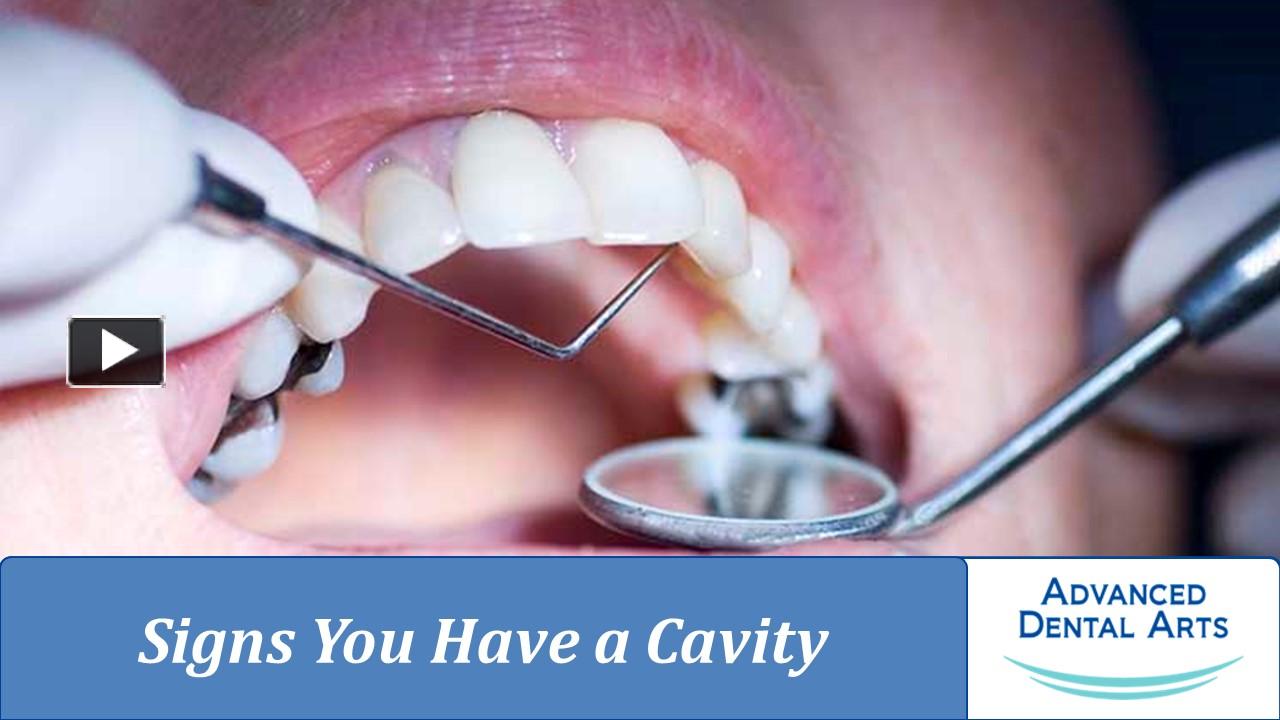 PPT – Stop Cavities in Their Tracks: Recognize the Warning Signs Today ...
