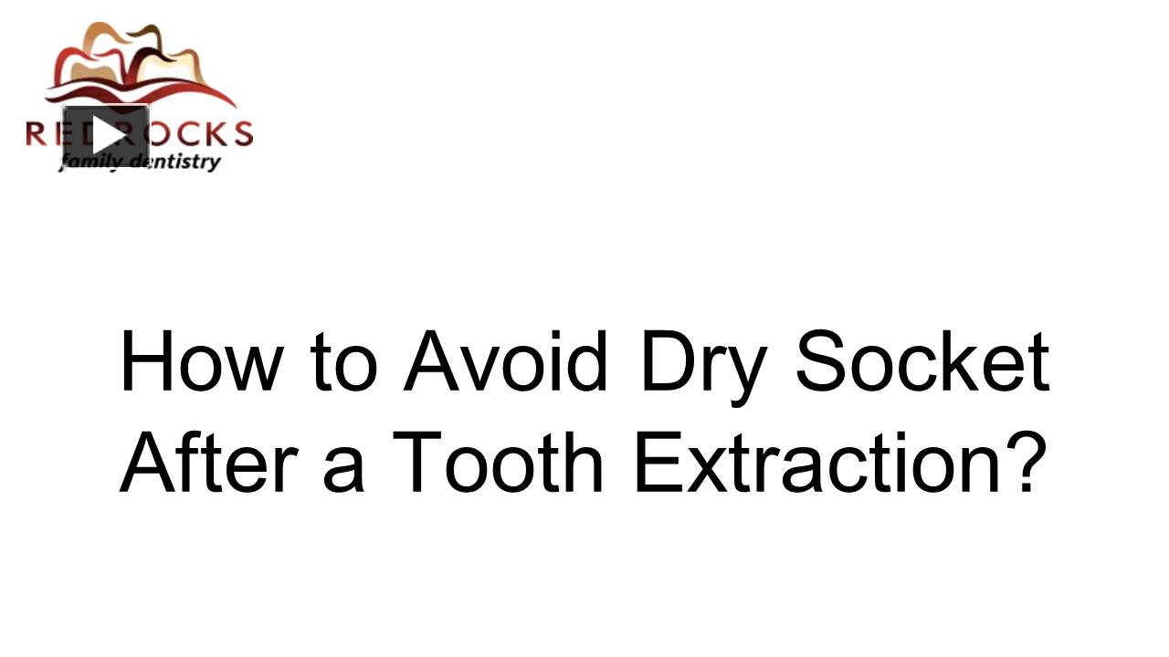 How to Avoid Dry Socket After a Tooth Extraction | Red Rocks Family ...