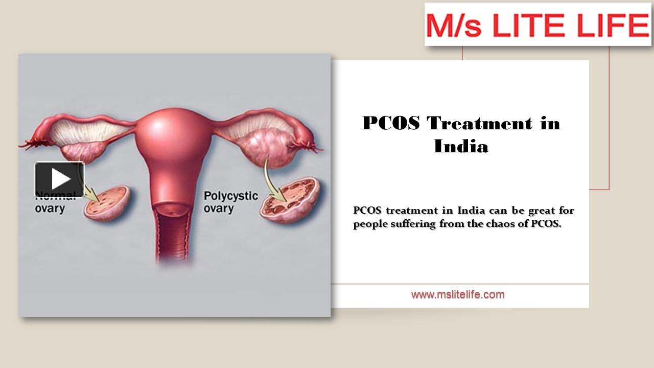 PPT – PCOS Treatment in India PowerPoint presentation | free to ...