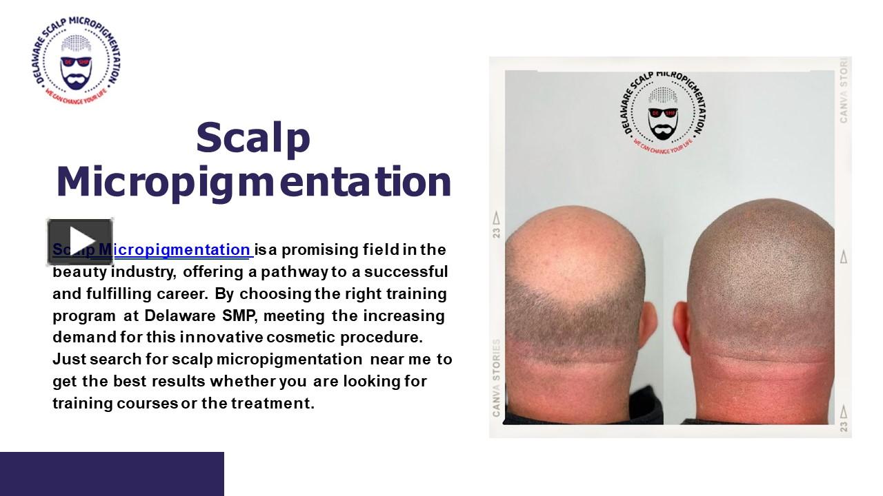 PPT – The Best Scalp Micropigmentation Treatment in Delaware PowerPoint ...
