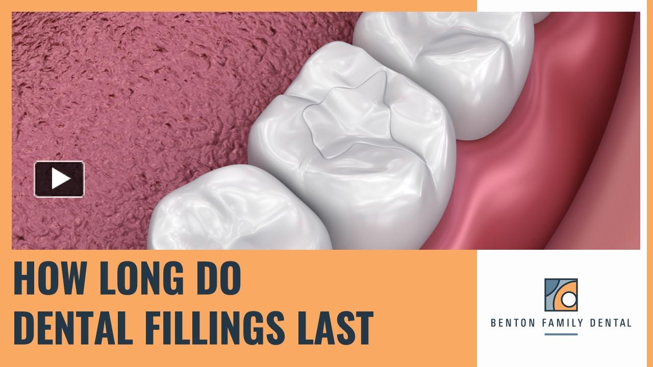 PPT – Understanding Dental Fillings: How Long Do They Last? (1 ...
