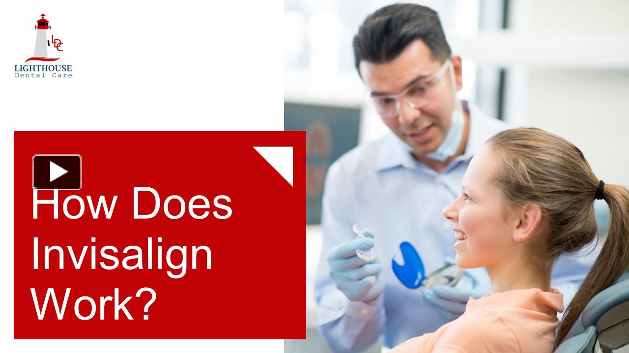 PPT – How Does Invisalign Work? PowerPoint presentation | free to view ...