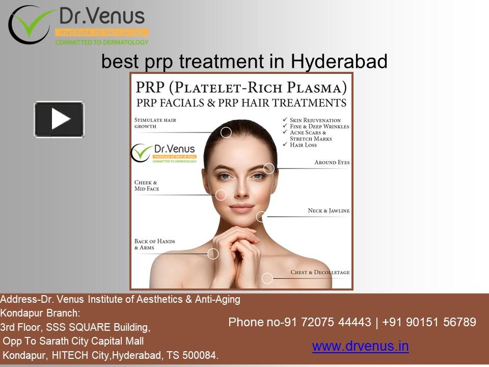 PPT – best prp treatment in Hyderabad PowerPoint presentation | free to ...