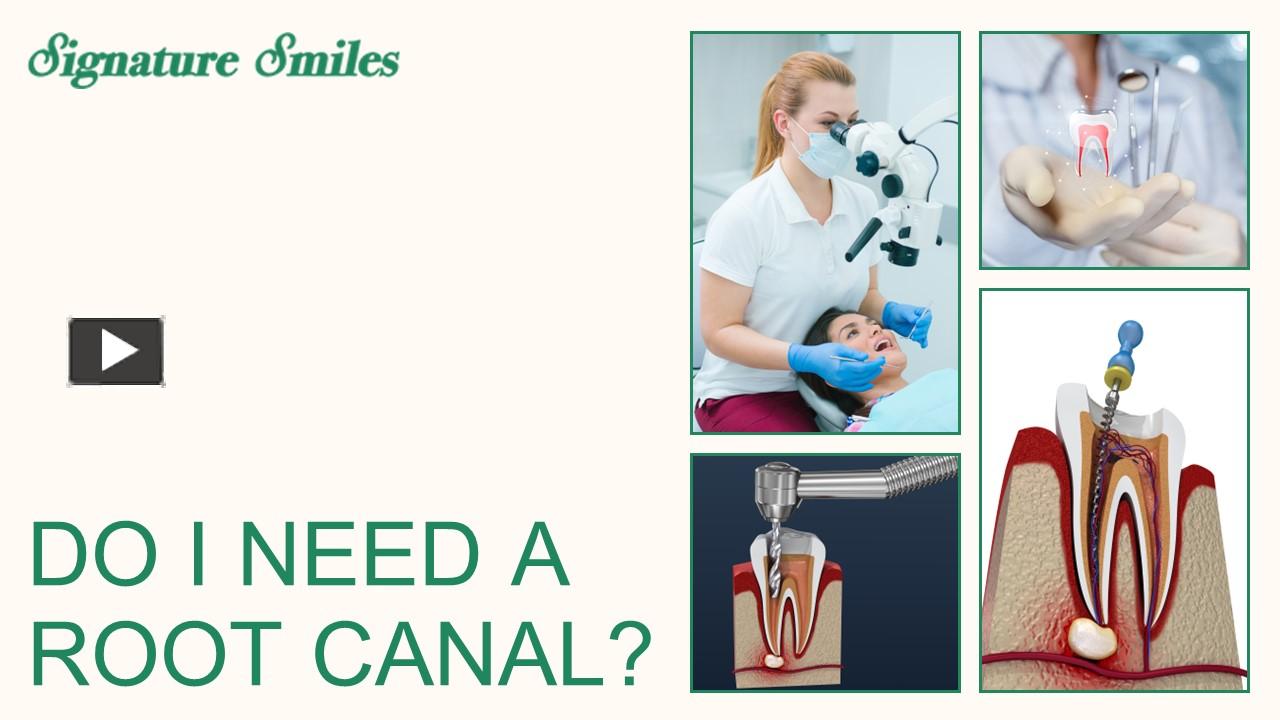 PPT – Do I Need a Root Canal? PowerPoint presentation | free to ...