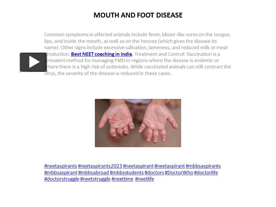 MOUTH AND FOOT DISEASE presentation | free to download